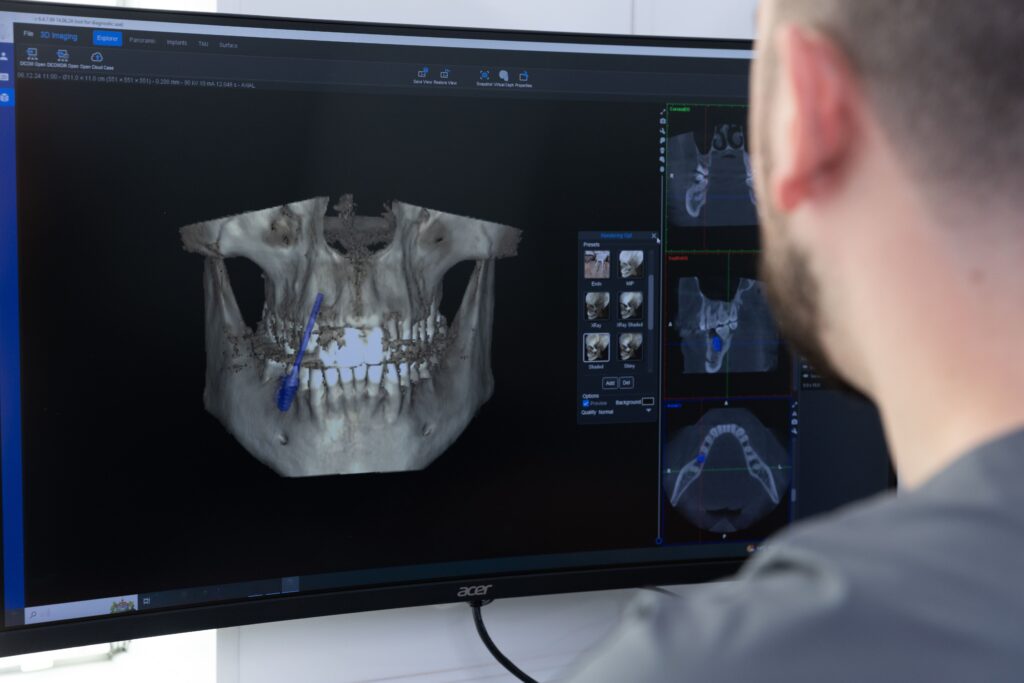 Cone Beam 3D Imaging: How It Improves Your Orthodontic Treatment Plan ...